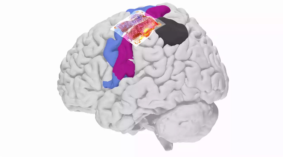 Human brain signals in record-breaking resolution Human brain signals in record-breaking resolution